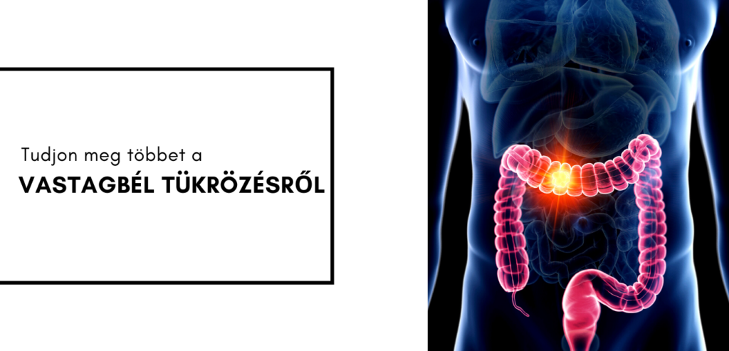 Vastagbél tükrözés | Endo-Kapszula